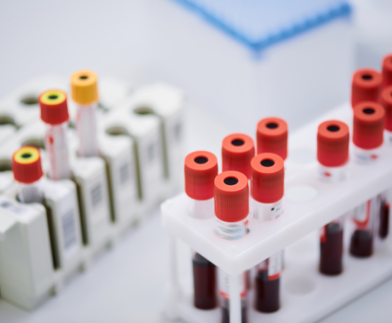 Significance of Blood Testing - PATH 24 LABORATORIES