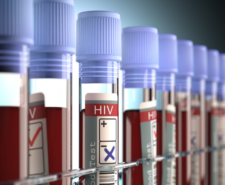 The Role of Blood Testing in HIV Management - PATH 24 LABORATORIES