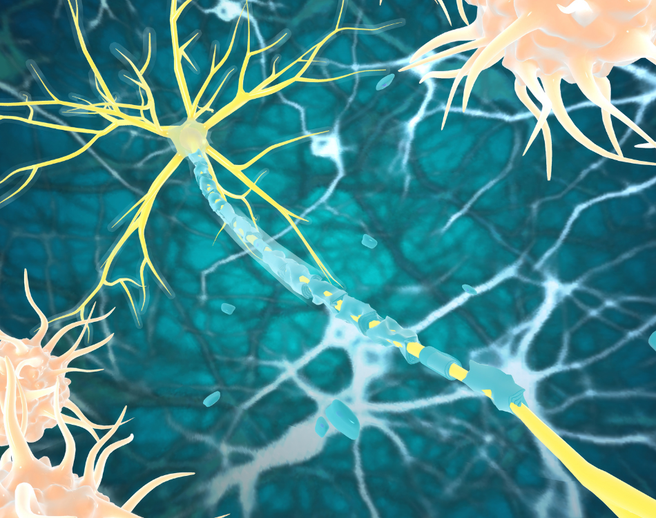 the Mysteries of Rare Diseases with Pathology - PATH 24 LABORATORIES