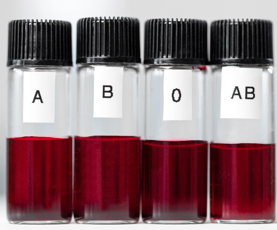 Blood Types: More Than Just a Trivia Night Answer - PATH 24 LABORATORIES