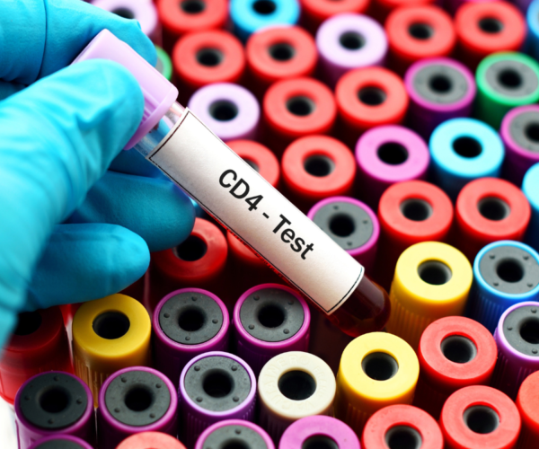 Understanding CD4 Count and HIV Management Through Blood Testing - PATH ...