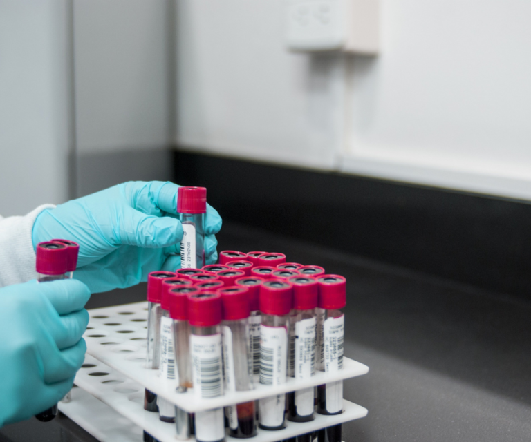 10 Common Blood Tests and What They’re Used For - PATH 24 LABORATORIES
