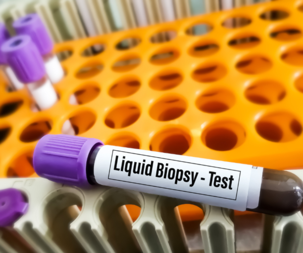 Liquid Biopsy: The Future of Early Cancer Detection Through a Simple ...