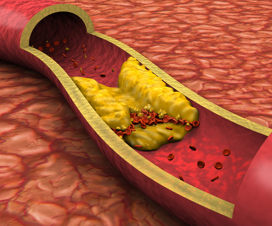 Understanding Cholesterol Test Results - PATH 24 LABORATORIES